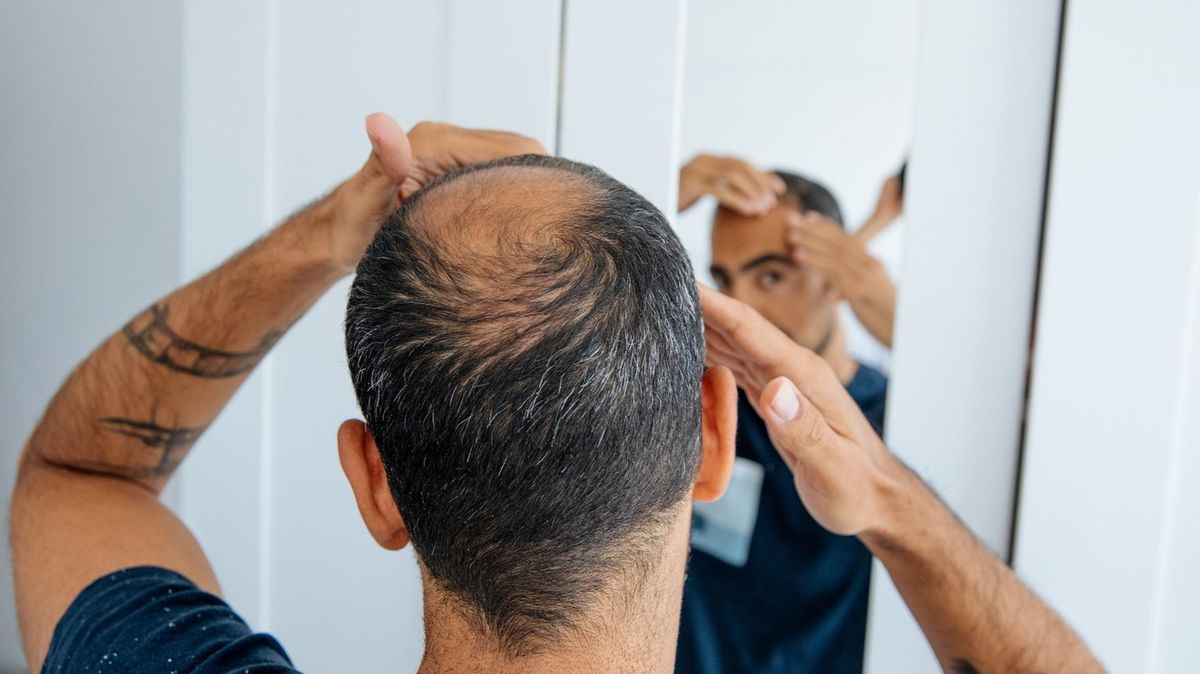 Scientists think we may have finally found a cure for going bald