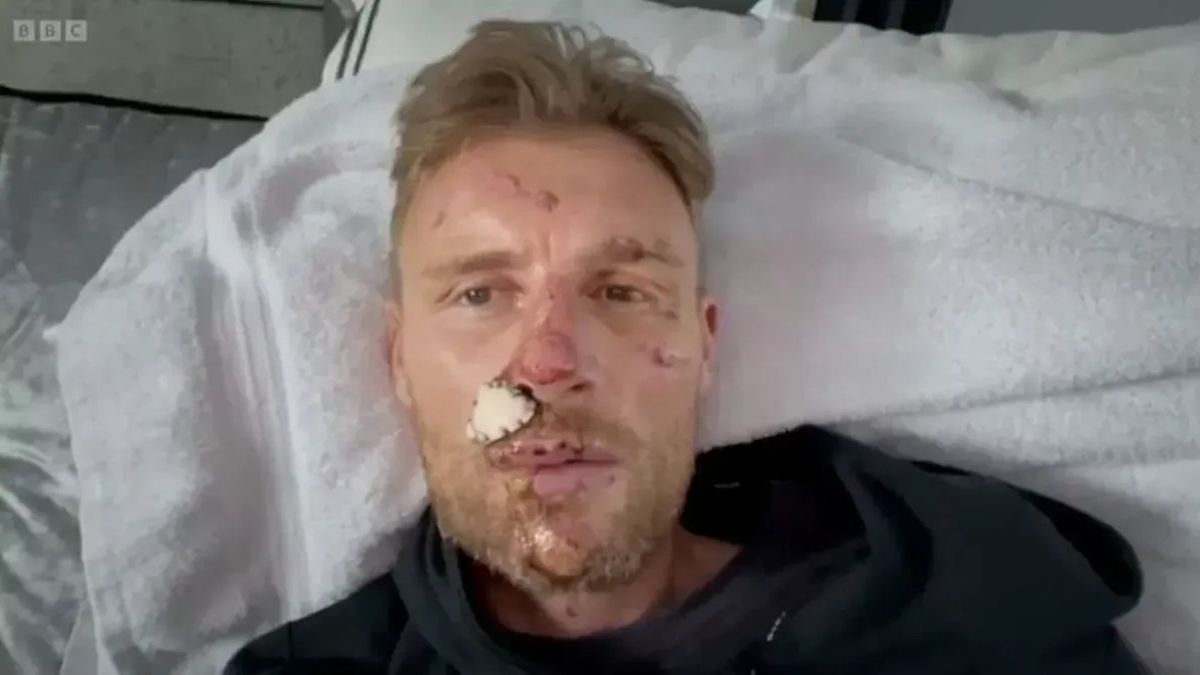 Freddie Flintoff shares harrowing details of Top Gear crash where he ...