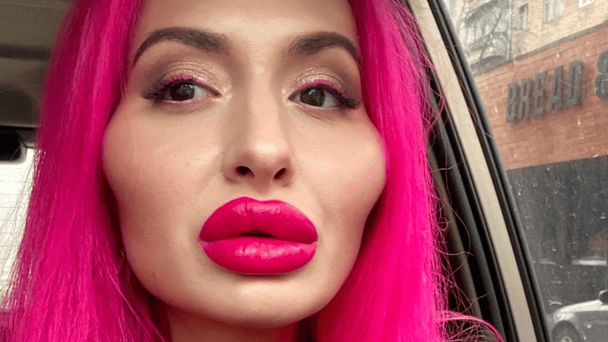 Woman with ‘world’s biggest cheeks’ shares rare image of what she ...