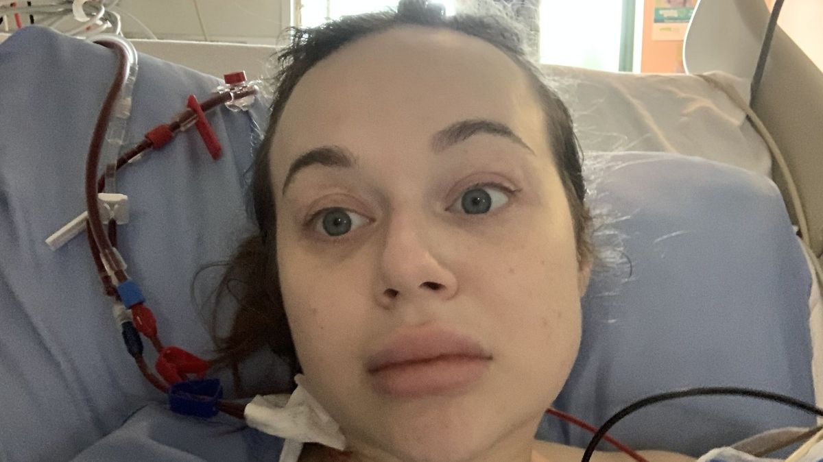 Mum issues serious warning after waking up from night out with ‘legs ...