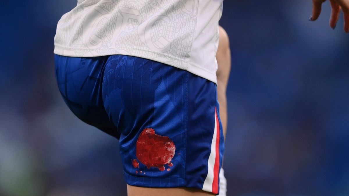 Chelsea FC Women wear shorts marked with simulated blood to address ...