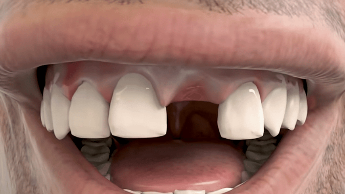 Simulation explains physical reason why you have nightmares about your ...