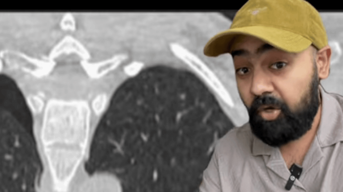 Doctor explains that they often miss serious condition that one in ten ...