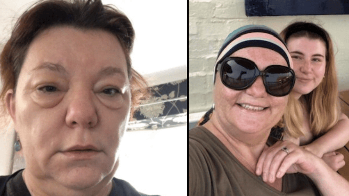 Mum's puffy eyes were actually a symptom of rare cancer as she issues ...