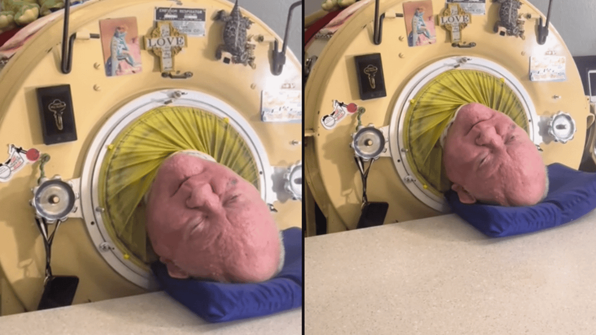 Man who has lived inside iron lung for more than 70 years shares what ...