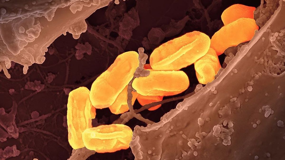 Official warning as serious typhus disease hits record case numbers