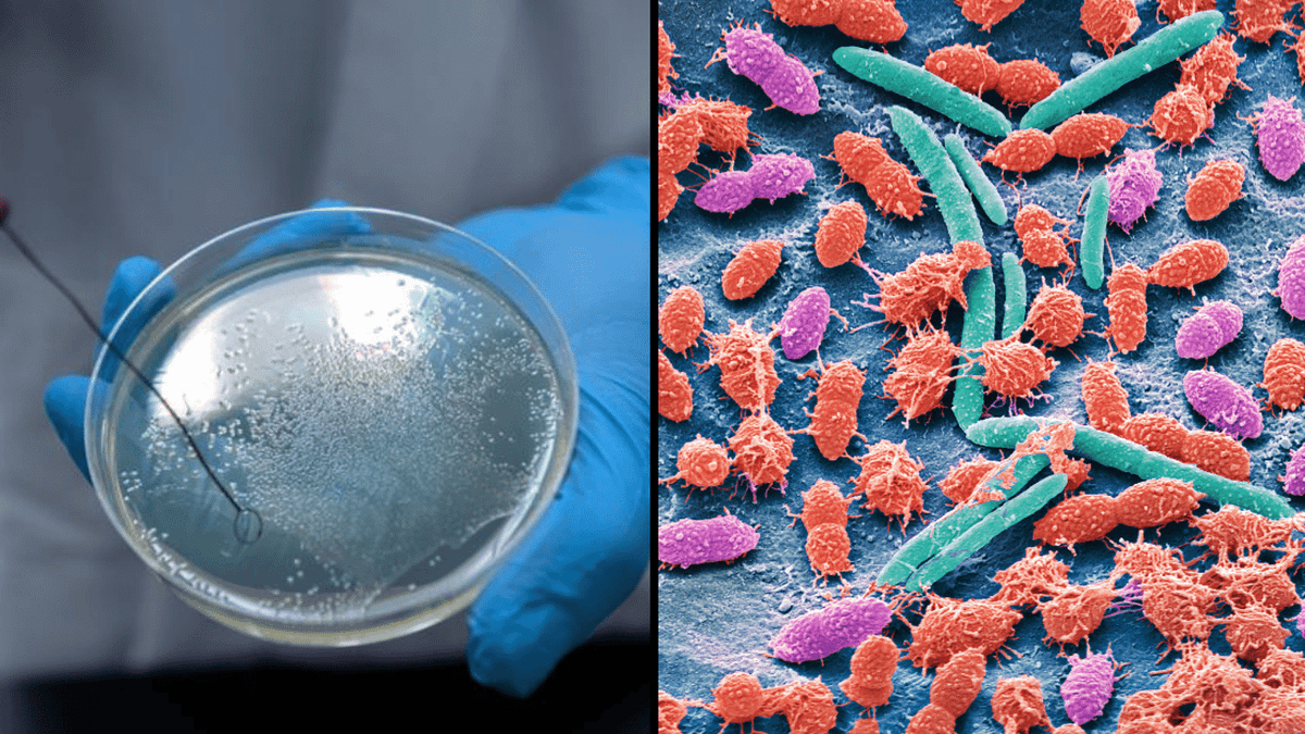 Scientists find 'deadly vampire bacteria' that have a thirst for human ...