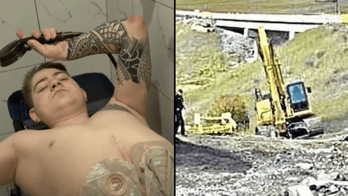 Man cut in half by forklift accident bravely shared a horrifying photo ...