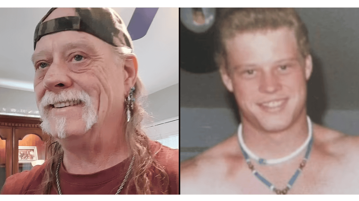 Man who's one of only 75 in the world to suffer from ‘demon face ...