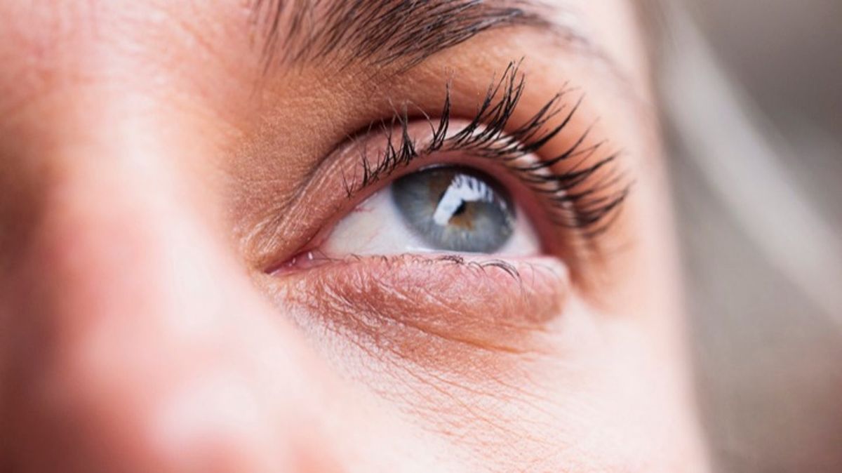 NHS has ‘urgent’ advice to people that get ‘floaters’ in eye