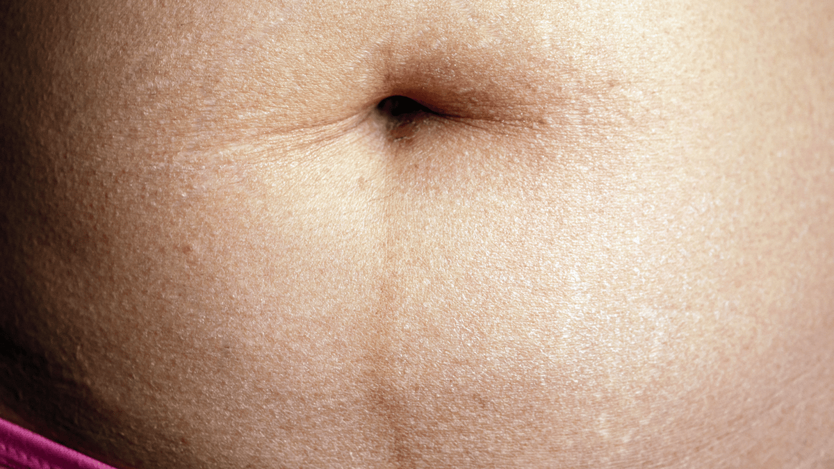 People gobsmacked after learning what faint dark line that appears on ...