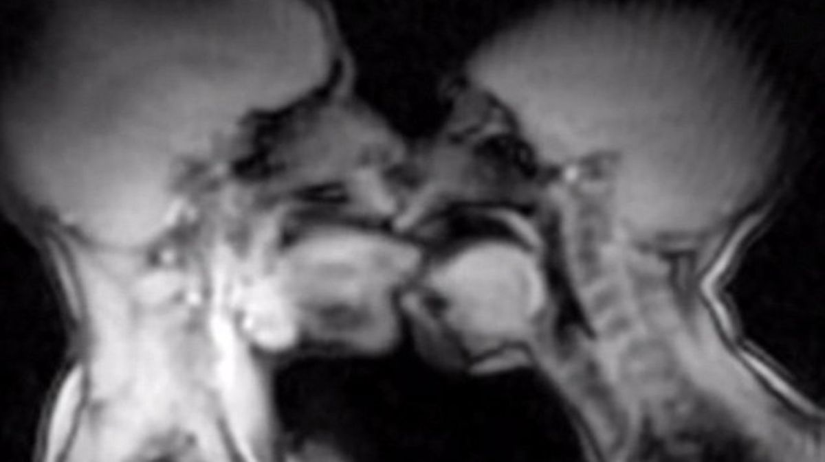 Scientists still can’t explain one detail after 8 couples had sex in ...