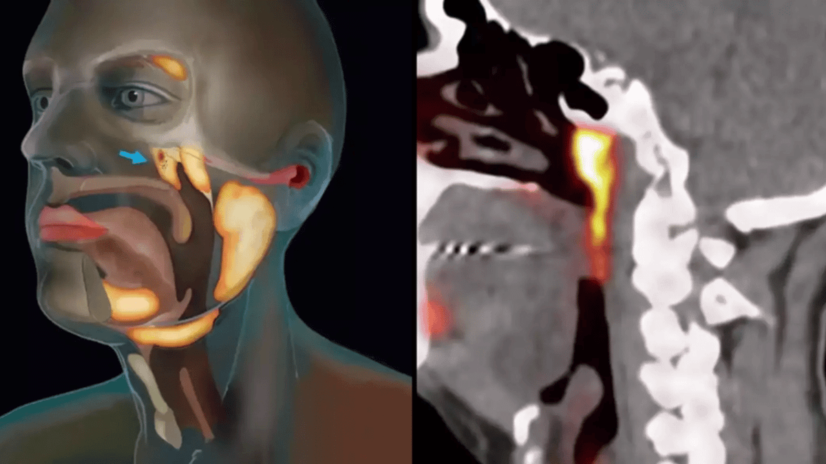 Scientists accidentally discovered brand new organ in the human body ...