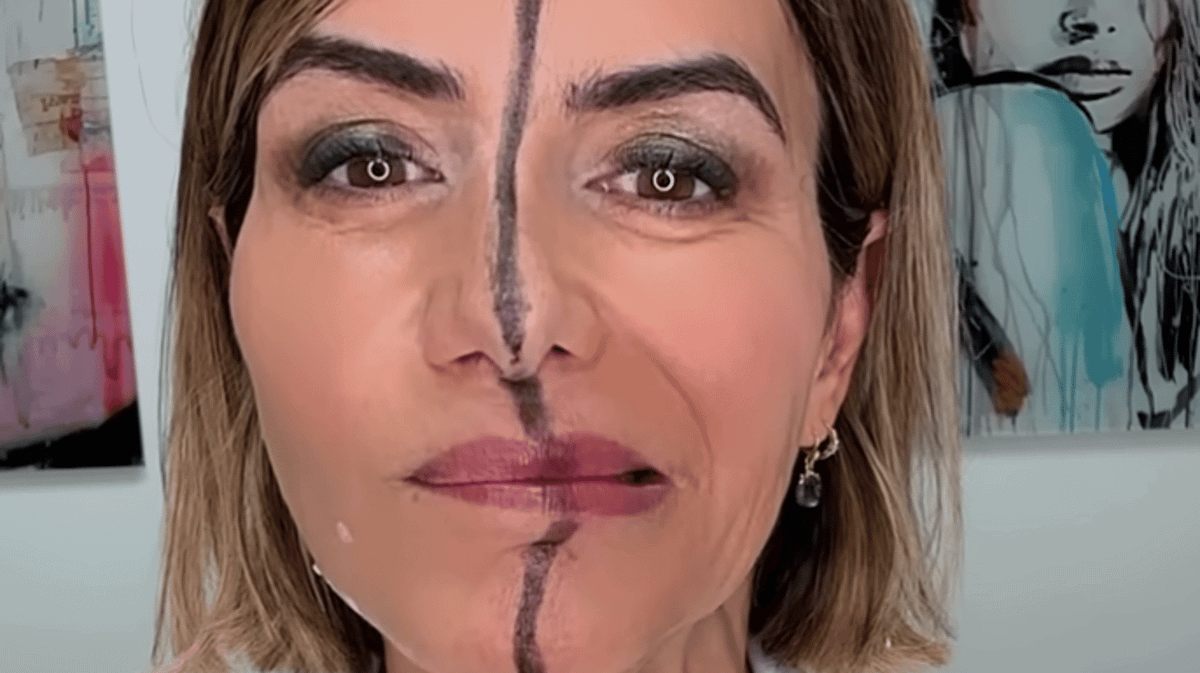 Woman only injects one half of her face with Botox to show what it does ...