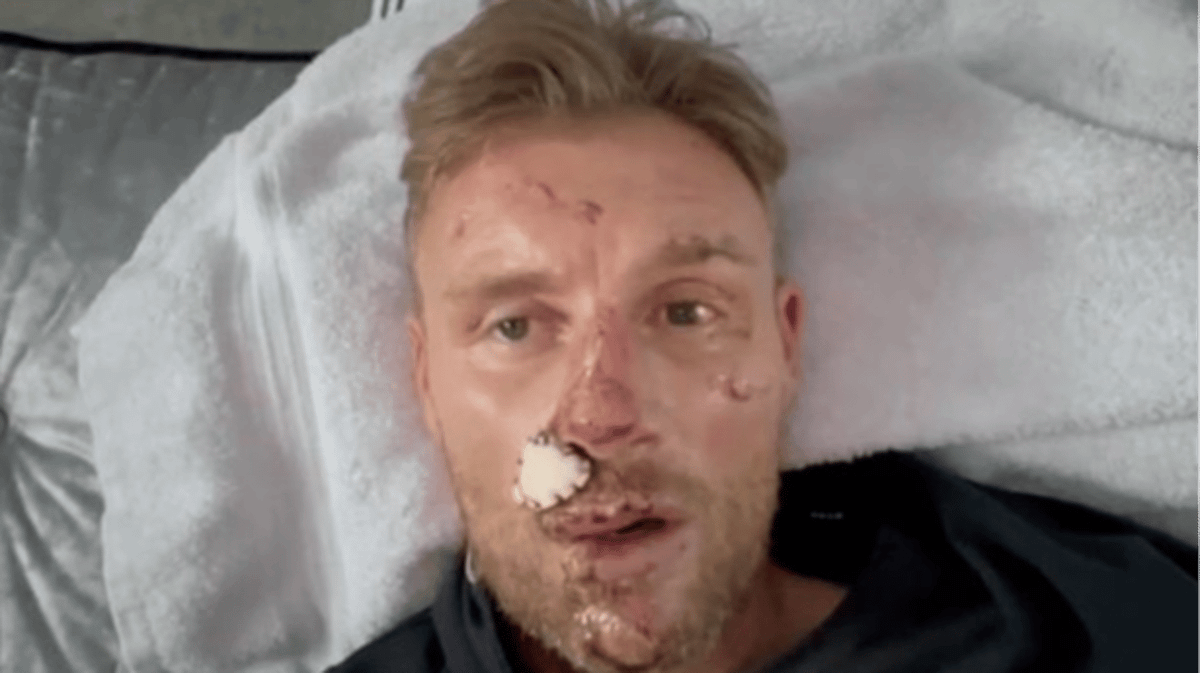 Freddie Flintoff makes heartbreaking admission about near-fatal Top ...