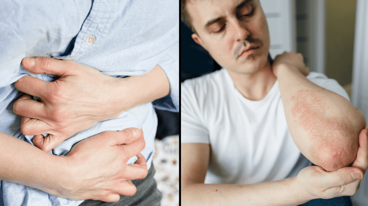 Symptoms of ‘invisible disease’ that half a million Brits suffer as ...