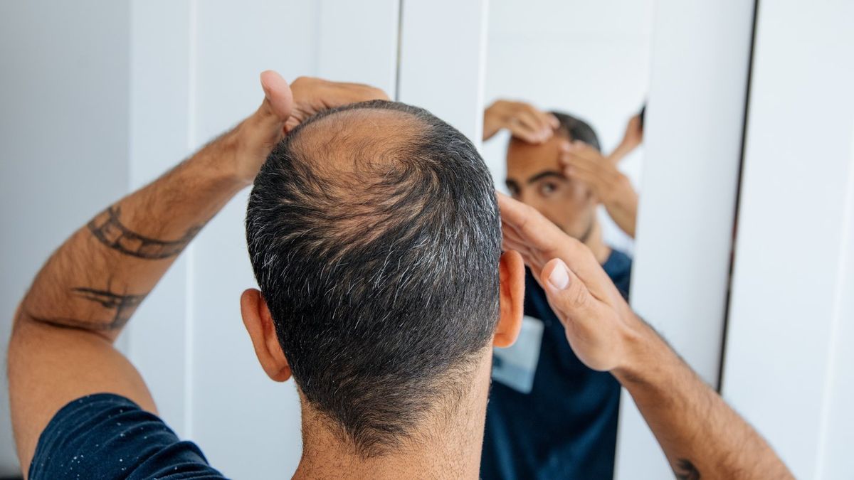 Creatine hair loss explained as study exposes truth about popular ...