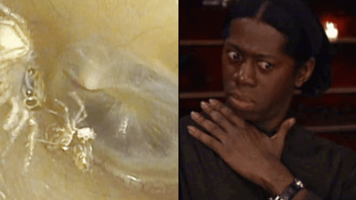Doctors find spider crawling and shedding skin inside woman's ear