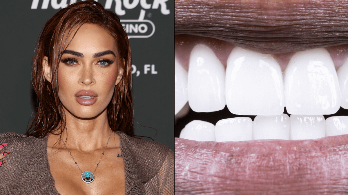 People are coming to realisation they're 'bottom teeth talkers' after ...