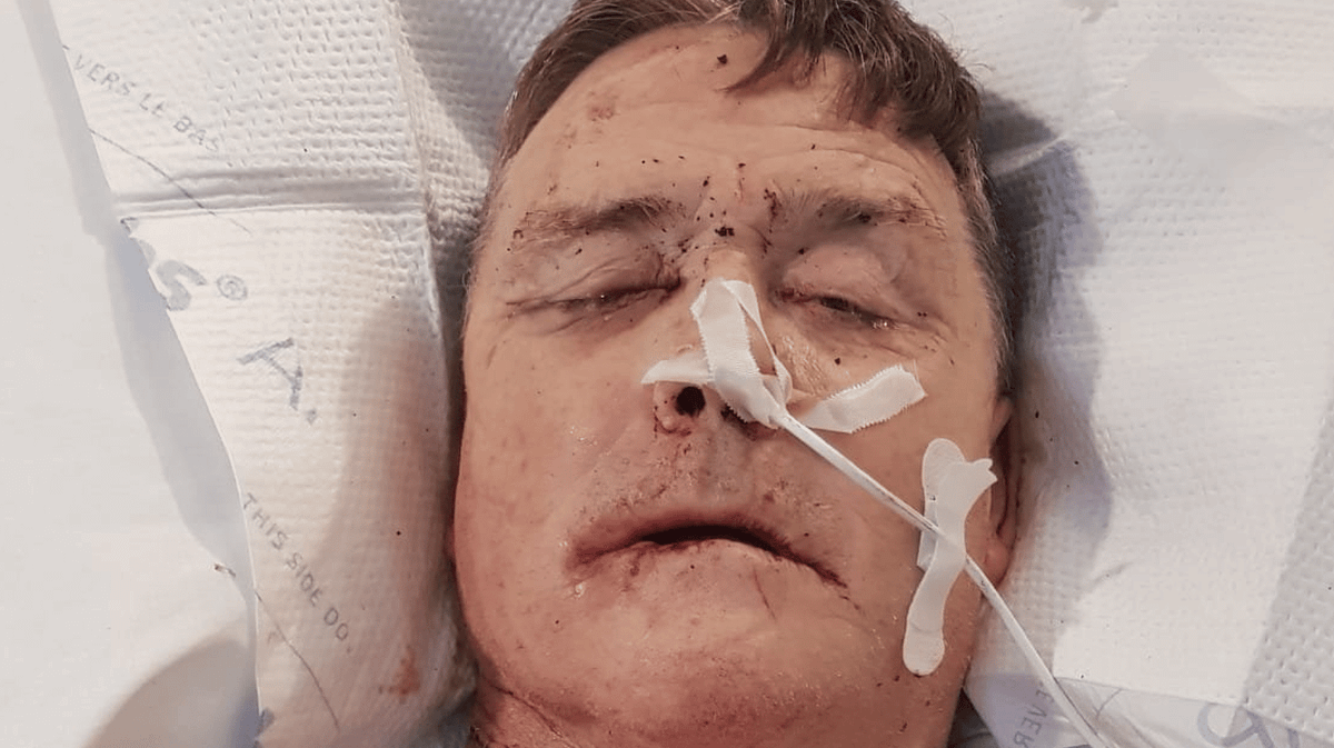 Man diagnosed with mouth cancer reveals gap in his teeth was a warning ...